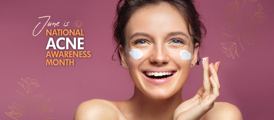 ACNE ON THE OCCASION OF NATIONAL ACNE MONTH – Ozone Signature